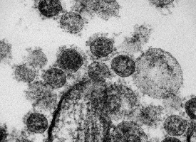 No room for COVID complacency as winter wave threatens | Australian ...